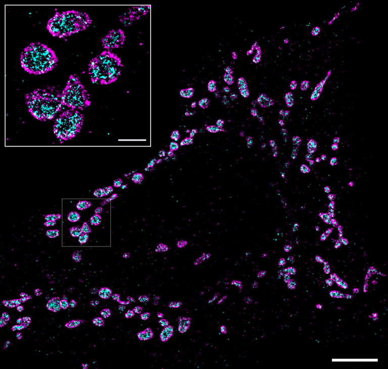 Immunofluorescence a simple overview | ONI