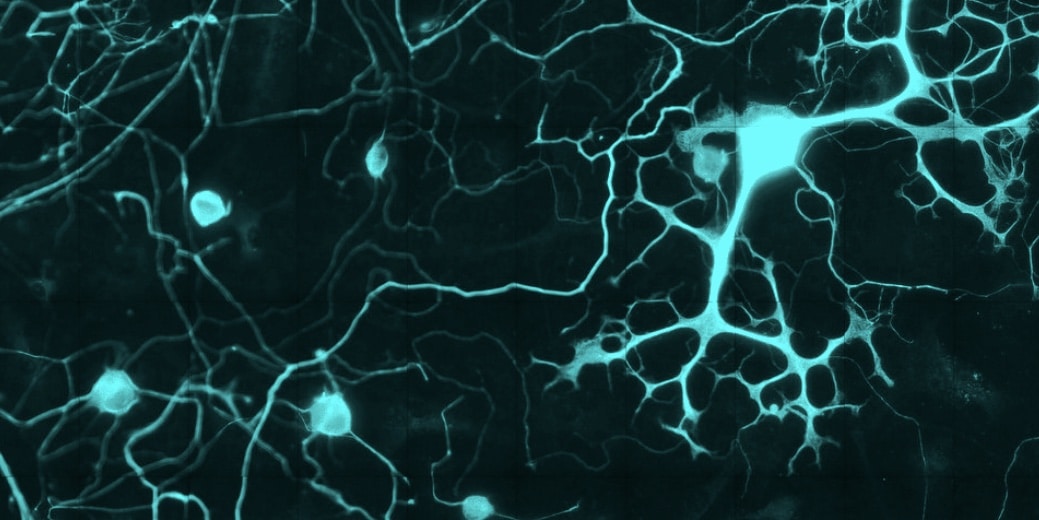 Getting started with super-resolution imaging of neuronal cultures | ONI