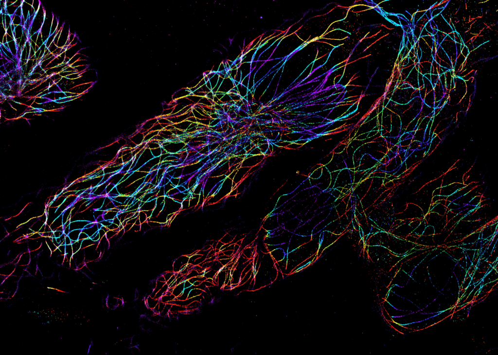 STORM microscopy | ONI