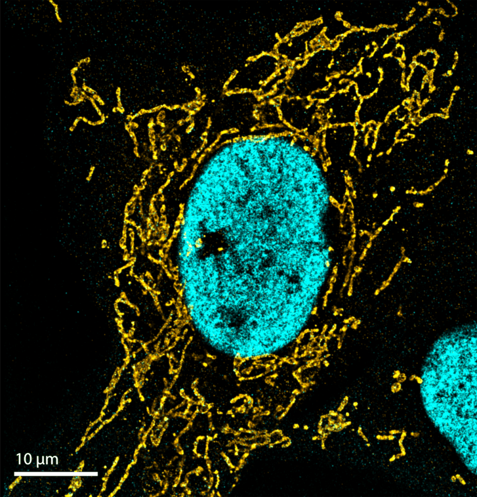 STORM microscopy | ONI