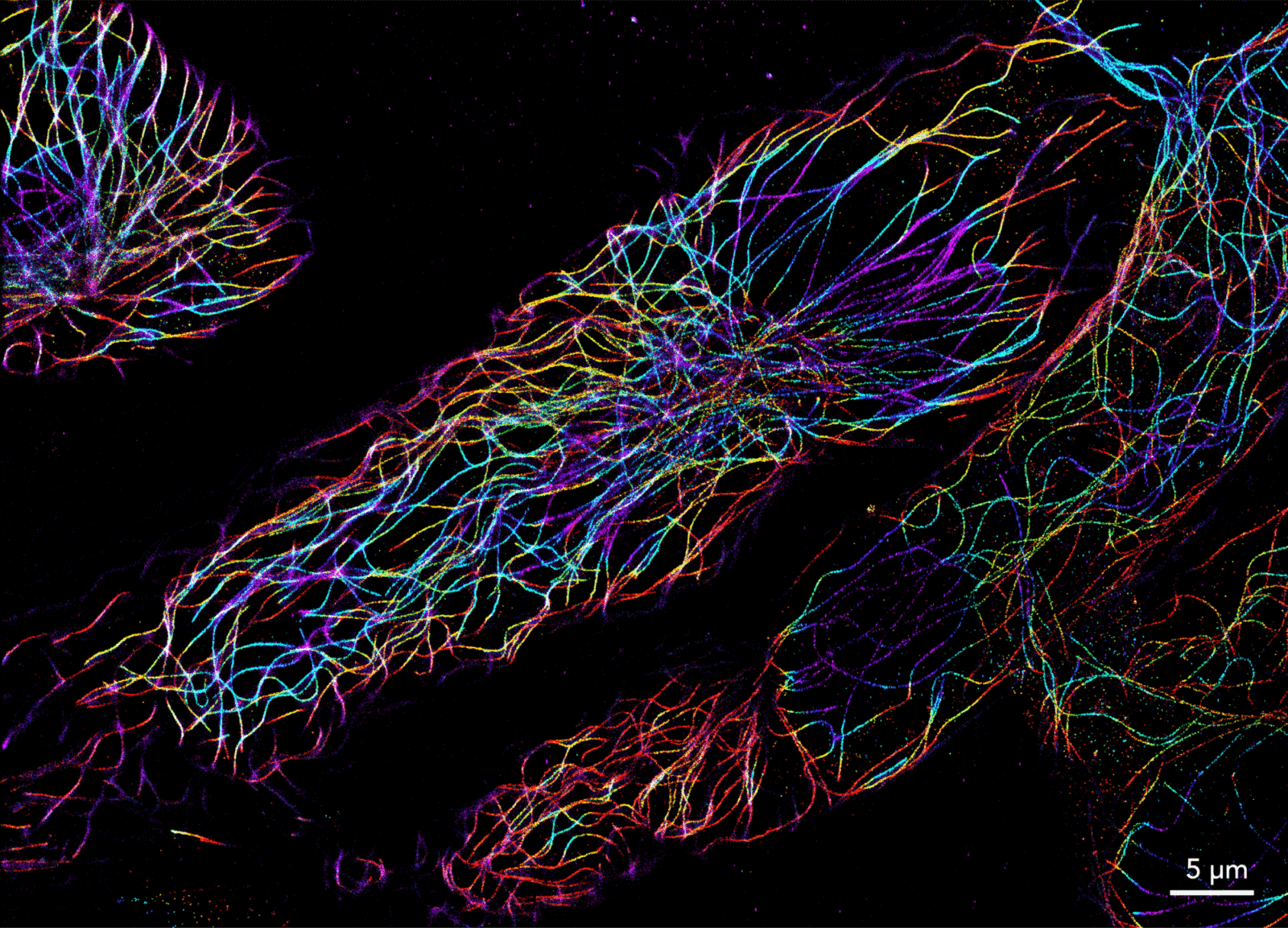 STORM microscopy | ONI