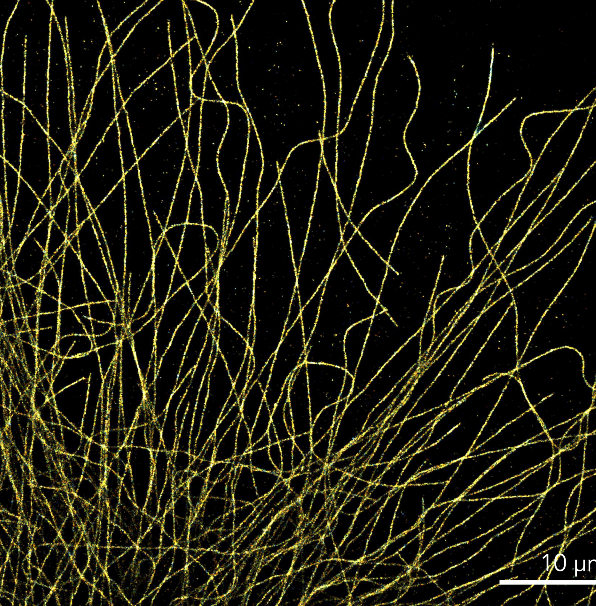 STORM microscopy | ONI