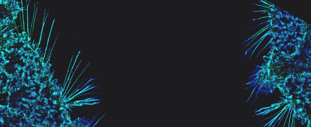 STORM microscopy | ONI