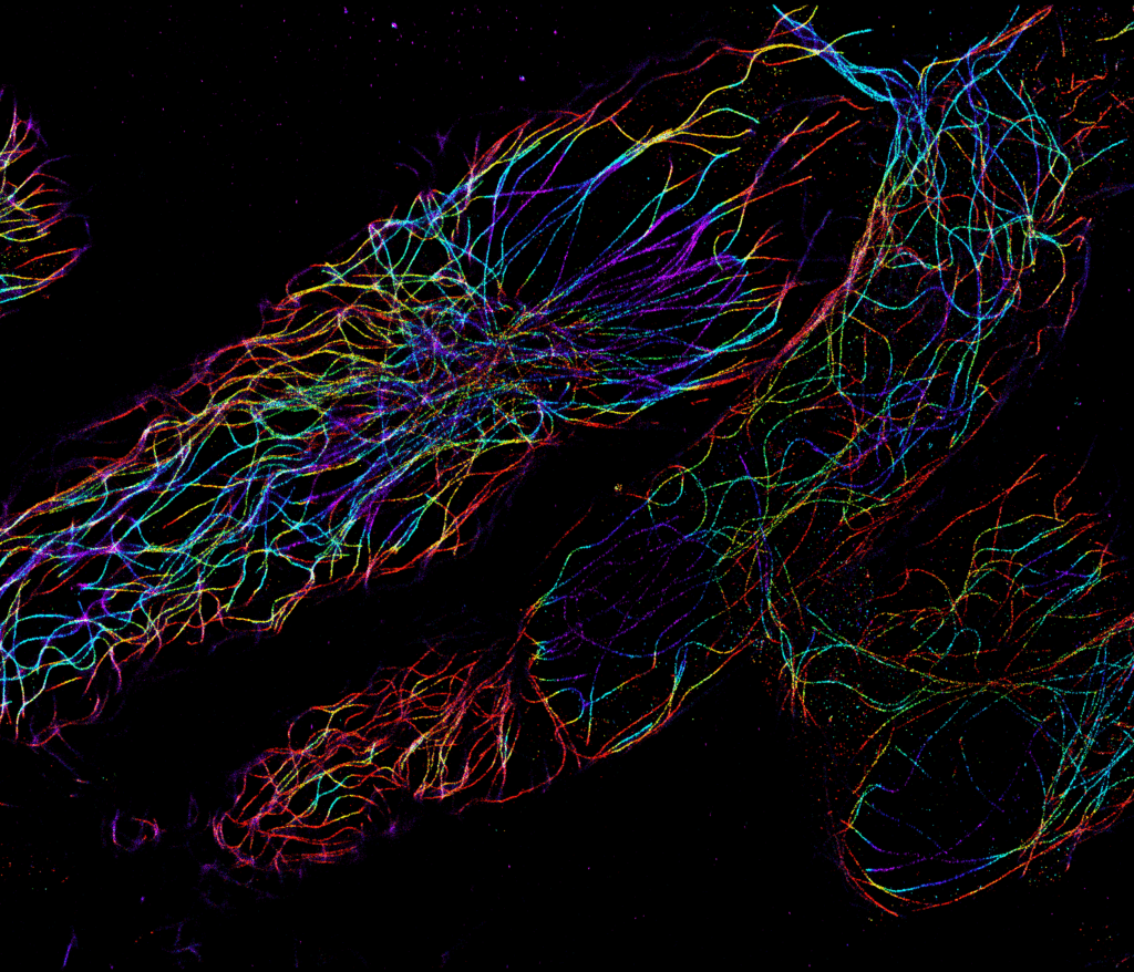 Why use Super-Resolution Microscopy? Starting with the basics | ONI